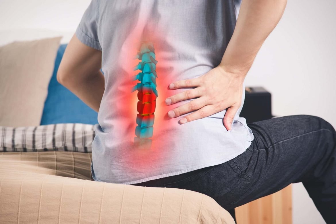 What Causes Sciatica to flare up? Quick Answers for Sciatica