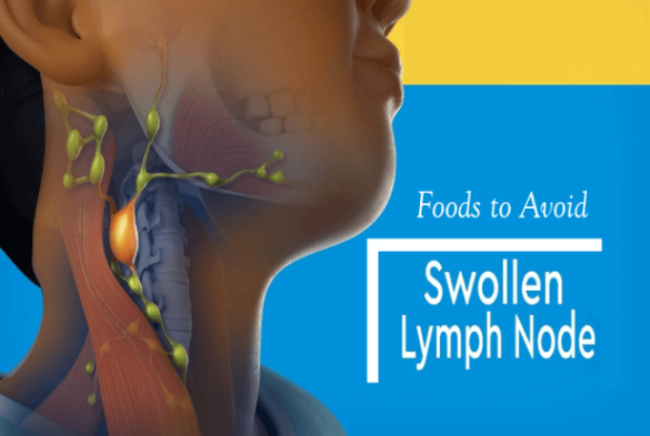 Foods To Avoid With Swollen Lymph Nodes