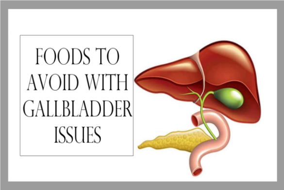 Foods to avoid with gallbladder issues