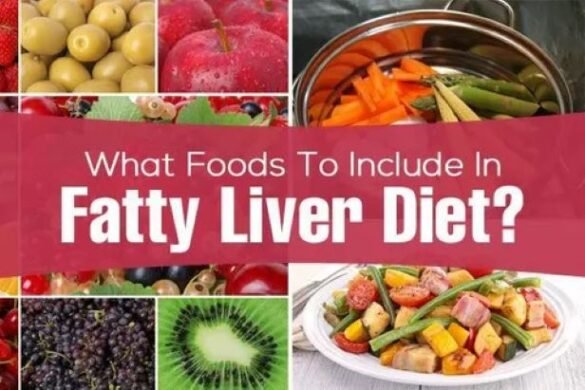 What foods should you eat to cure fatty liver?