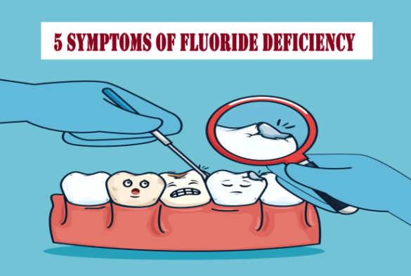 Symptoms of fluoride deficiency