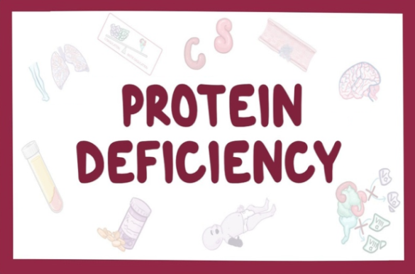 Health risks of protein deficiency